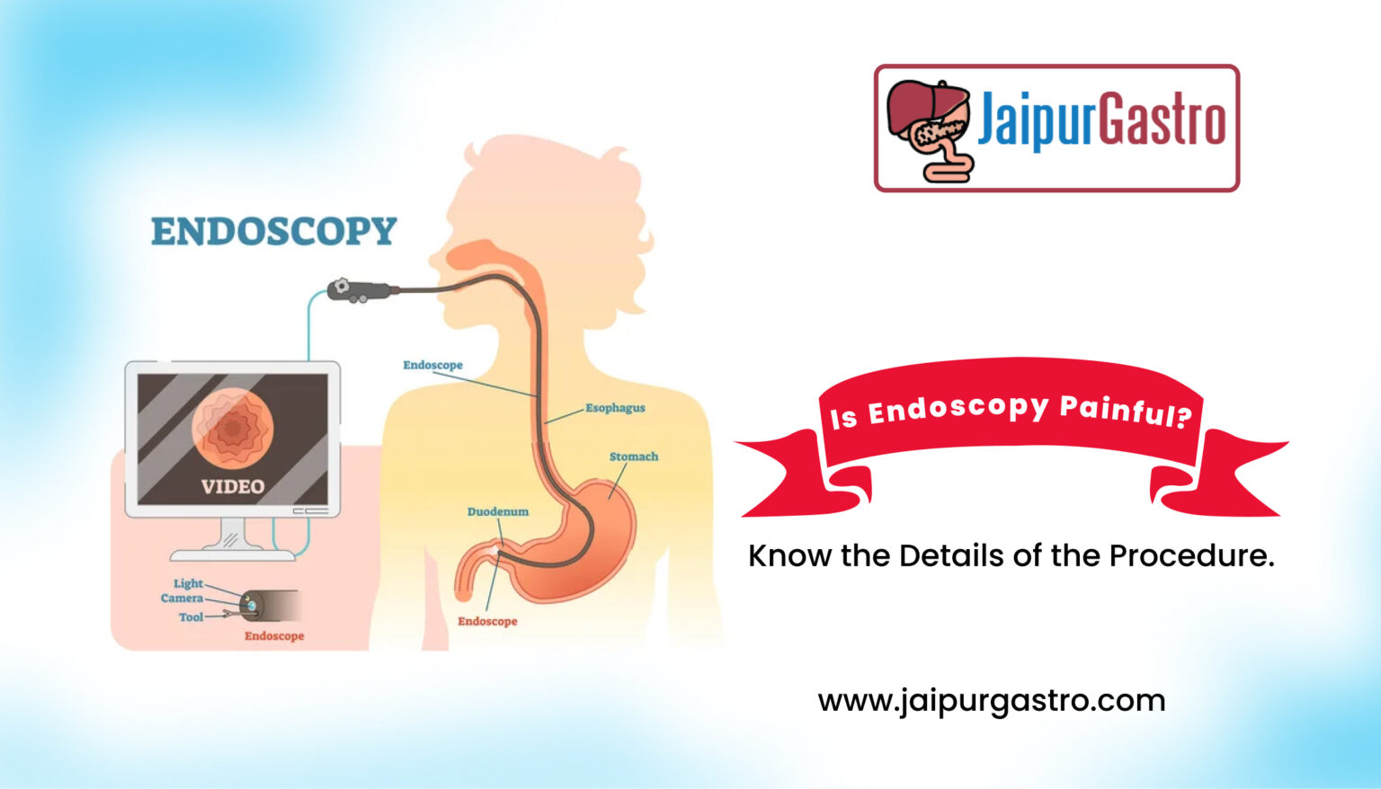 Is Endoscopy Painful? Know the Details of the Procedure?