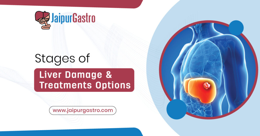 Stages of Liver Damage and Treatment Options