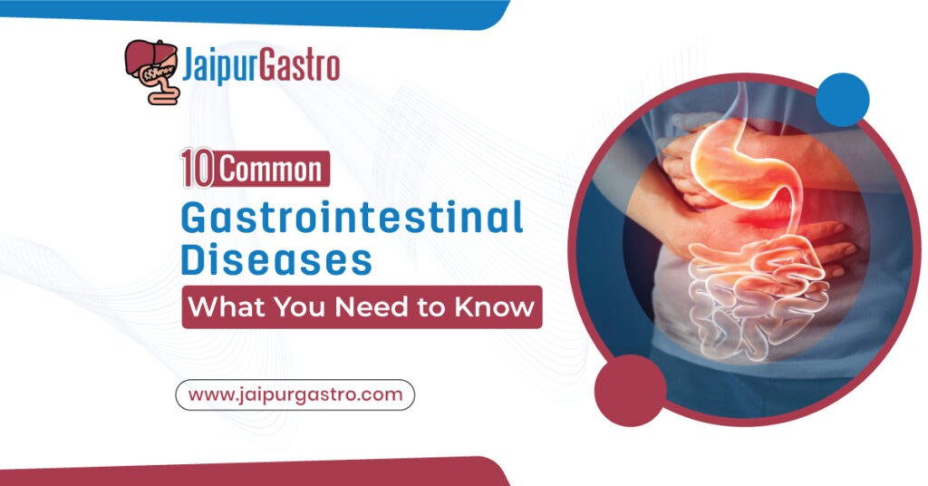 10 Common Gastrointestinal Diseases you need to know