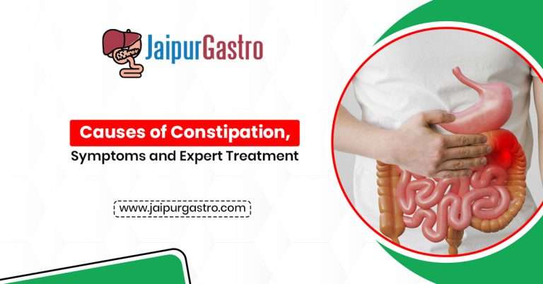 Causes of Constipation, Symptoms & Expert Treatment Guide